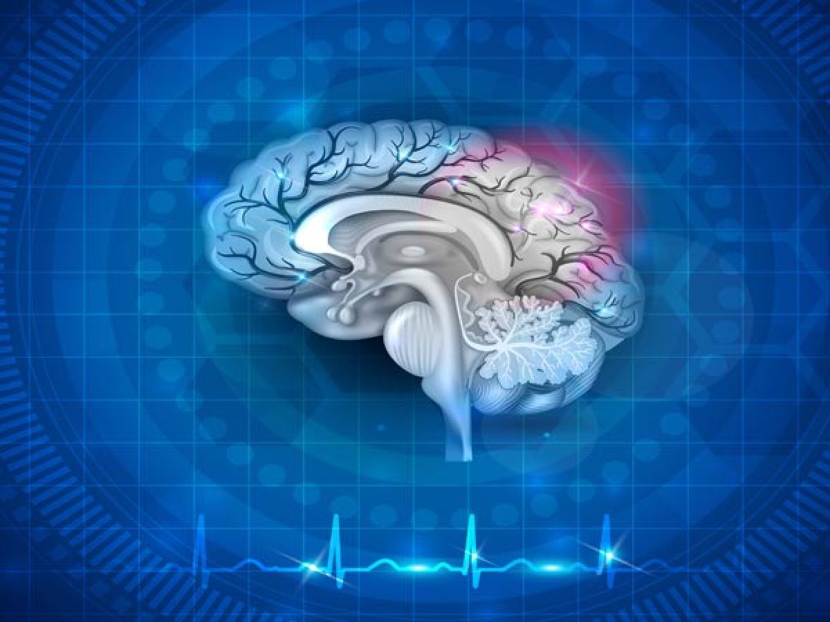 Acidente Vascular Cerebral Lacunar