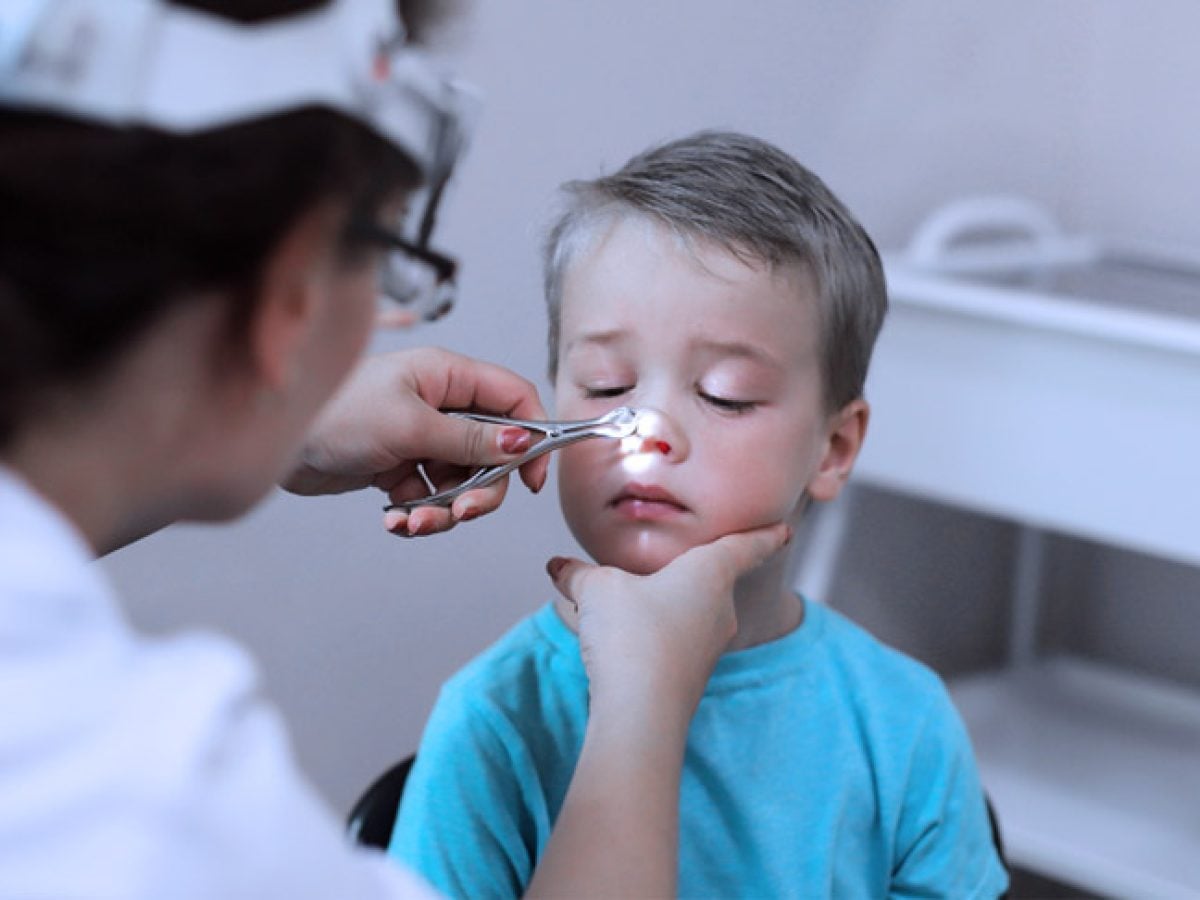 Diagrama De Amigdalas E Adenoides