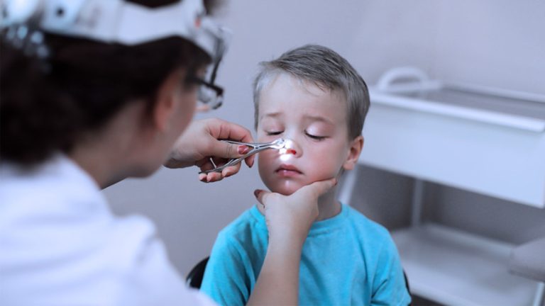 ADENOIDE | O que é, sintomas, hipertrofia e tratamento