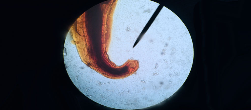 ANCILOSTOMOSE - Transmissão, sintomas e tratamento - MD.Saúde