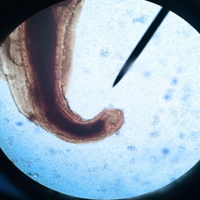Huevo De Ancylostoma Duodenale