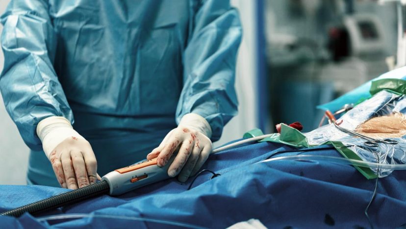 Aneurisma: O que é, causas, sintomas e tratamento