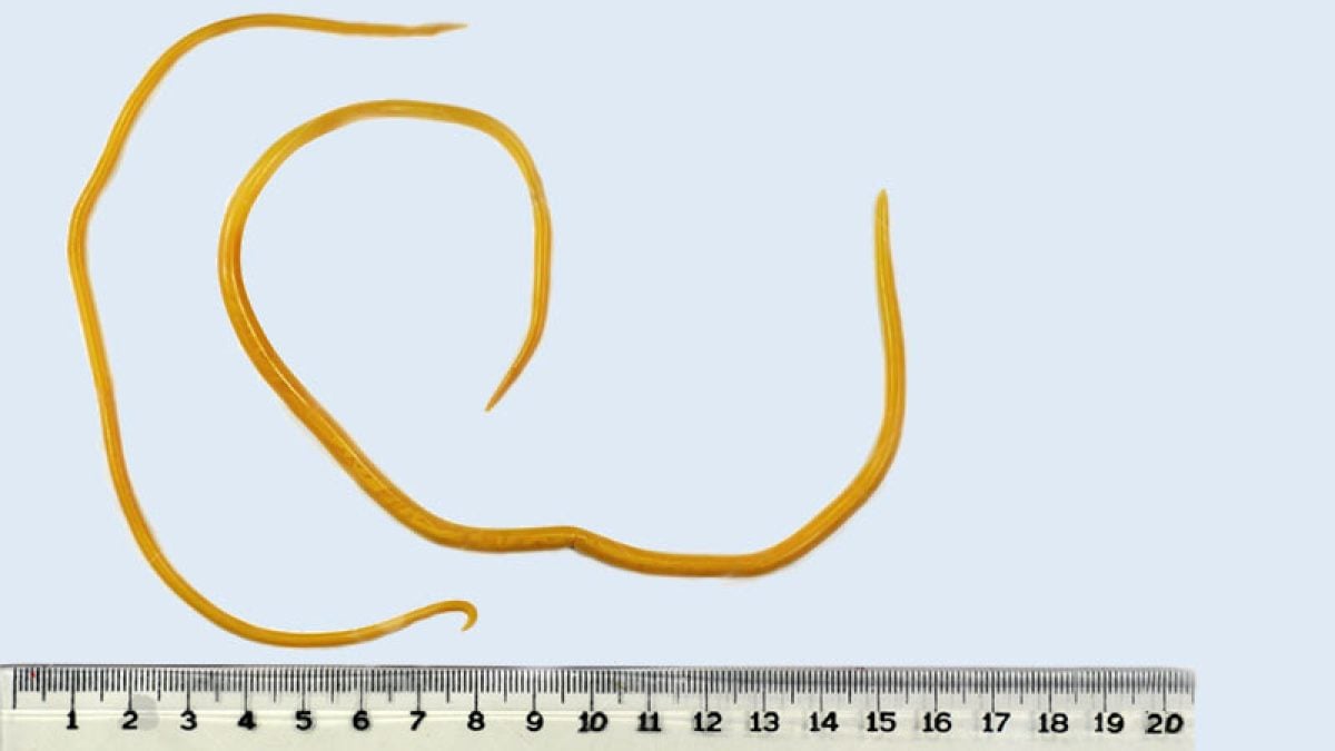 Ciclo De Vida Do Ascaris Suum