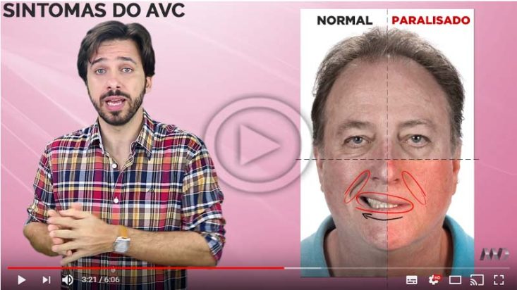 7 sintomas do AVC - Derrame cerebral | MD.Saúde