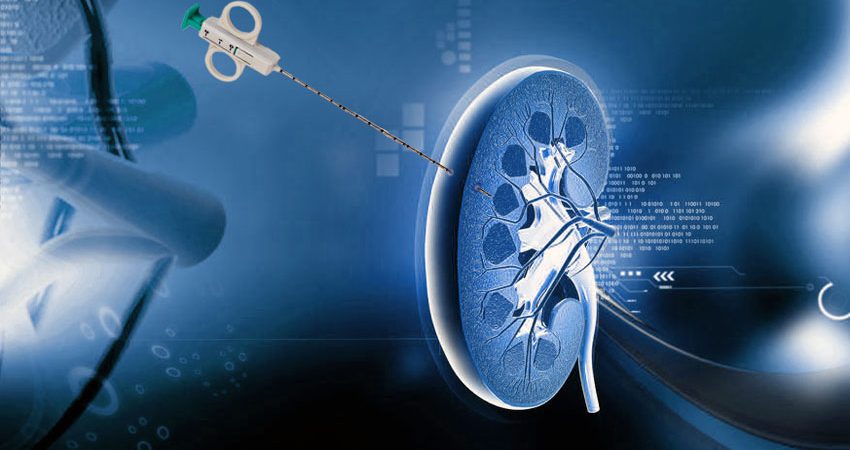 BIÓPSIA RENAL - Indicações, precauções e riscos | MD.Saúde
