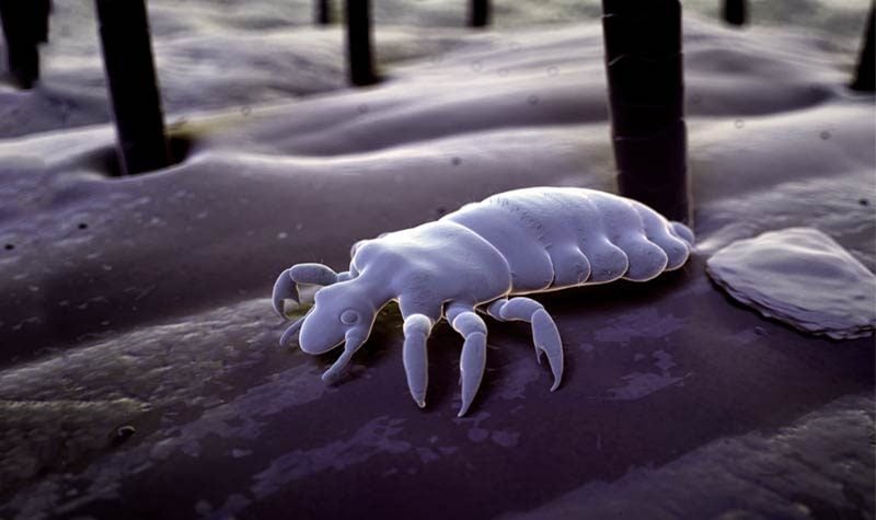 PEDICULOSIS PÚBICA (LADILLA) – Síntomas, Causas y Tratamiento » MD.Saúde