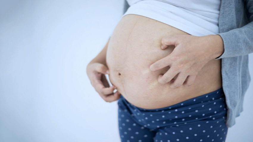 COLESTASIS DEL EMBARAZO - Causas, síntomas y tratamiento - MD.Saúde