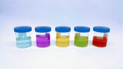 COLOR DE LA ORINA (naranja, verde, azul, roja...) • MD.Saúde