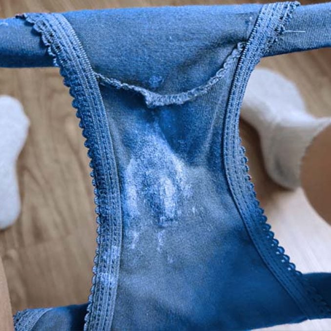 Que Significa Que Mi Flujo Sea Blanco Y Grumoso - Infoupdate.org