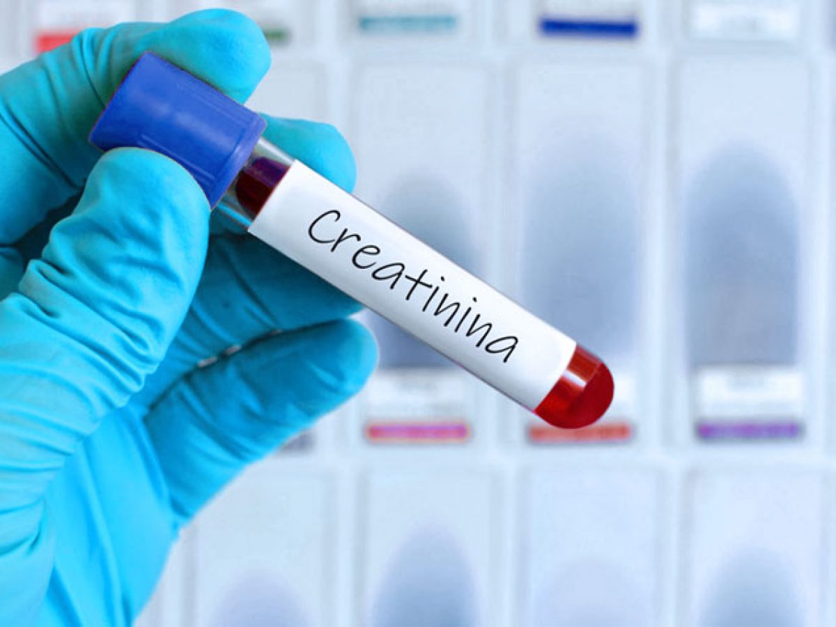 Causas De Creatinina Alta Creatinina: O Que Significa E Qual Exame