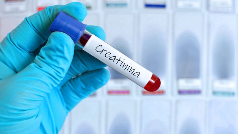 Creatinina y urea: qué son y valores normales