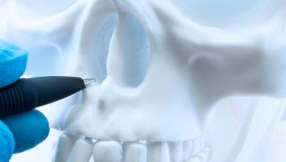 Desvio de septo: causas, sintomas e tratamento