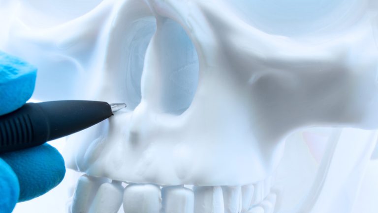 Sangrados de nariz (epistaxis): causas y tratamiento