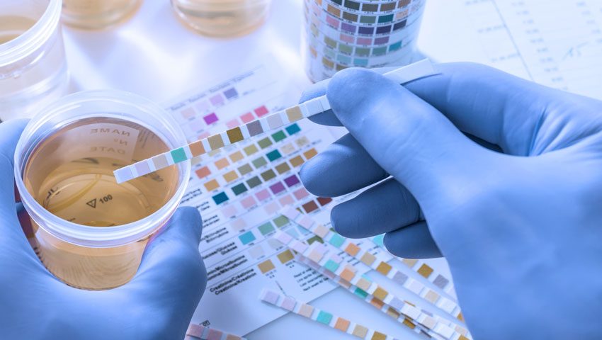 EXAME DE URINA (EAS)- Leucócitos, nitritos, hemoglobina... - MD.Saúde