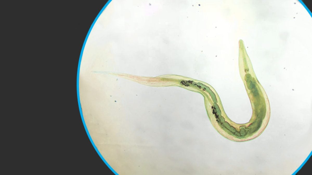 Oxiuros En Adultos Remedio Casero