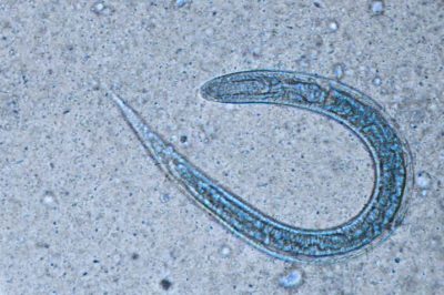 OXIURÍASE (enterobíase) - Infecção pelo Enterobius vermicularis » MD.Saúde