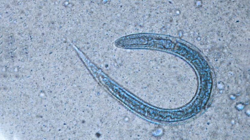 Albendazol: dosis y efectos secundarios | MD.Saúde