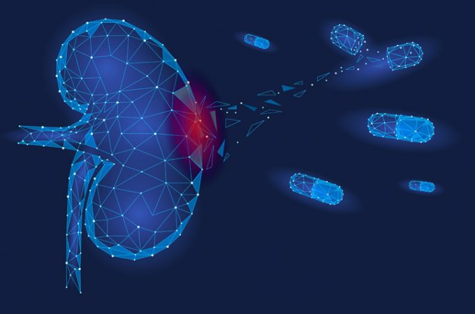 CÁLCULO RENAL - Causas y Síntomas - MD.Saúde