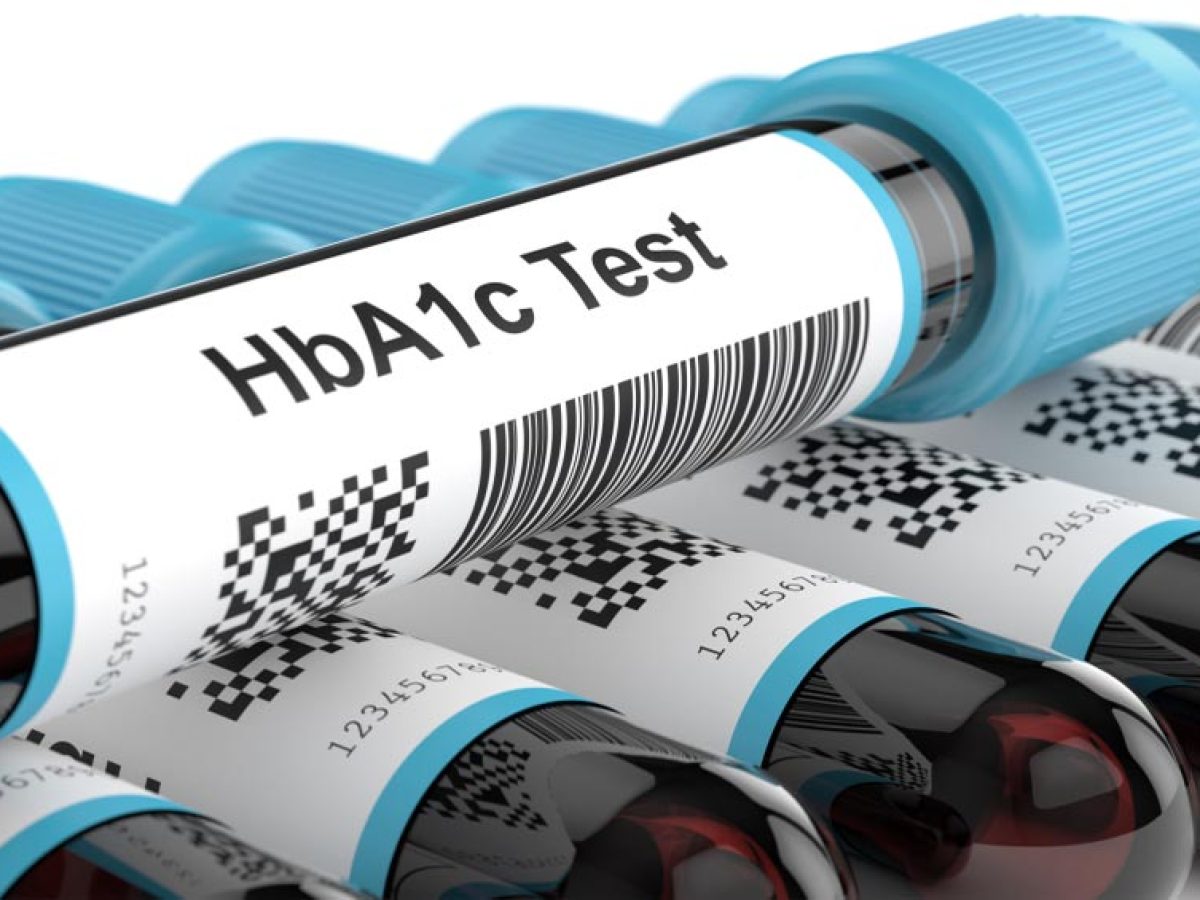 Teste De Hemoglobina Quais São Os Exames De Sangue Para Diabetes