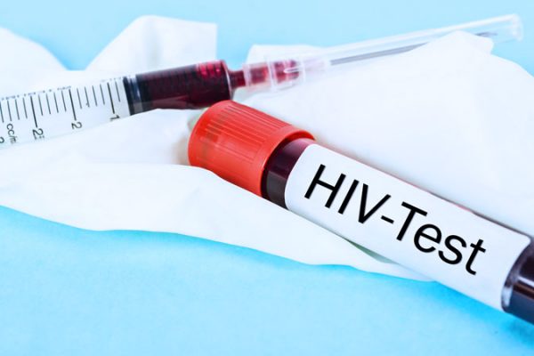 COMO SE PEGA AIDS? - Formas de transmissão do HIV | MD.Saúde