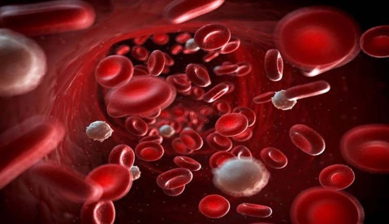 10 sinais e sintomas da leucemia (todos os tipos)