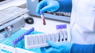 Leucocitose (leucócitos altos): principais causas