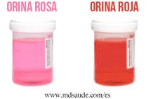 Color de la orina: naranja, verde, azul, roja...