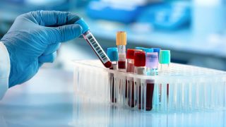 VHS, PCR, LDH, Ferritina e CK no exame de sangue