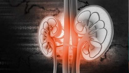 PIELONEFRITIS - Causas, síntomas y tratamiento • MD.Saúde