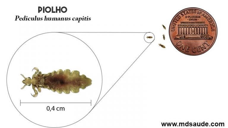 Piolhos e lêndeas (pediculose): transmissão e tratamento