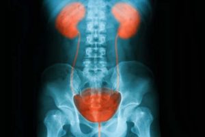 Exame urocultura - Quando fazer e como colher - MD.Saúde