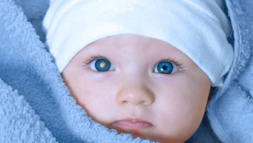 Brotoeja em bebê (miliária): Causas e tratamento