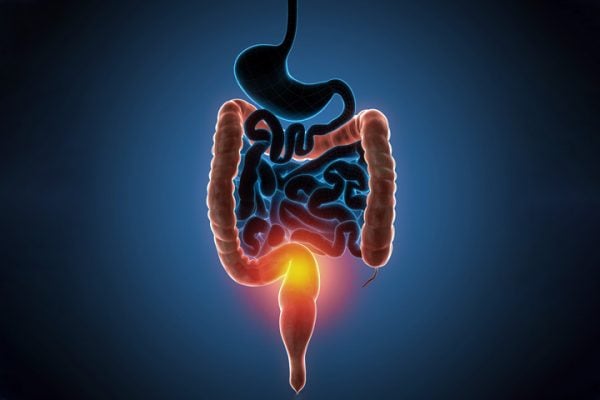 QUISTE PILONIDAL - Causas, Síntomas y Cirugía | MD.Saúde