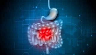 Sangue nas fezes:14 causas de hemorragia digestiva
