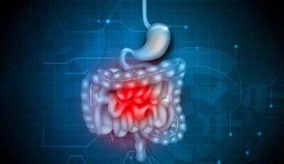 14 CAUSAS DE SANGRE EN LAS HECES • MD.Saúde