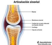 Sinovitis de cadera: qué es, síntomas y tratamiento