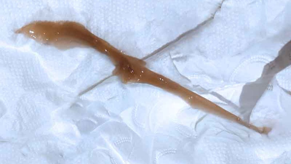 Tampao Mucoso Humano