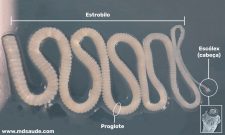 TENÍASE | O que é, ciclo, sintomas e tratamento