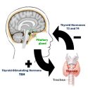 Subclinical Hypothyroidism (High TSH and Normal T4)