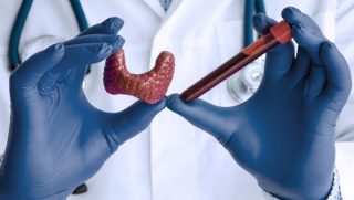 Free T4 and TSH Levels: Understanding Thyroid Blood Tests