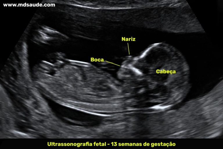 13 semanas de gravidez | Gestação semana a semana
