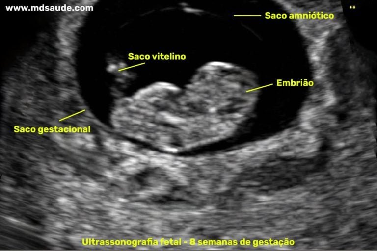 8 semanas de gravidez | Gestação semana a semana