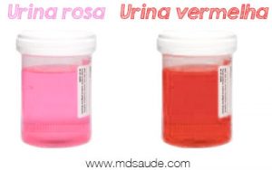 Alterações na cor da urina (Urina Verde, Roxa, Laranja, Azul...) | MD.Saúde